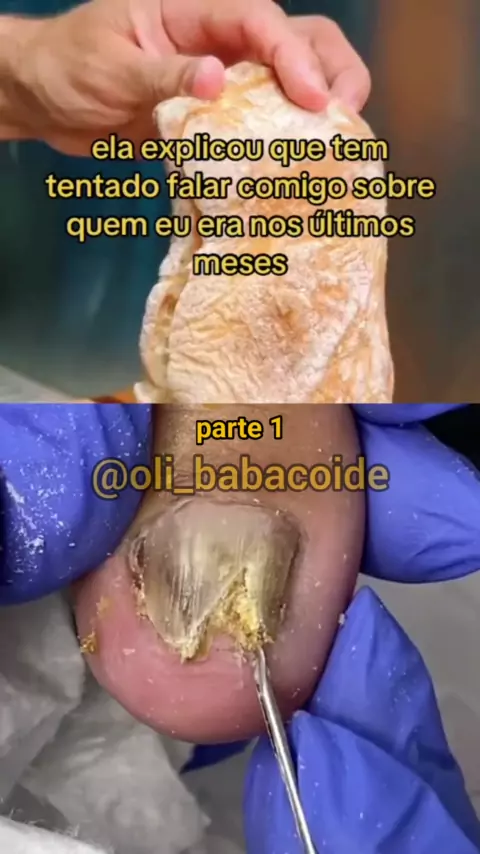 princess.bunniii & bunni.bzka reddit| Discover